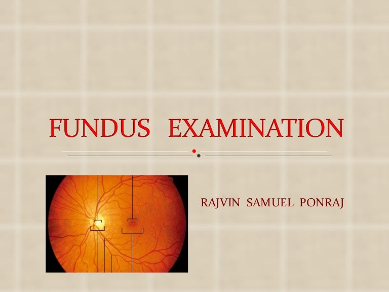 Fundus examination
