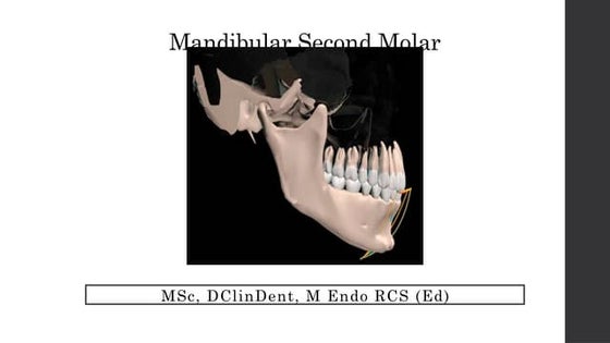 Maxillary second molar | PPTX | Dental Health | Diseases and Conditions