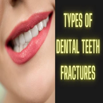 Types Of Dental Teeth Fractures | PDF