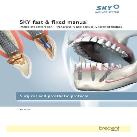 000244GB_SKY fast & fixed manual.pdf