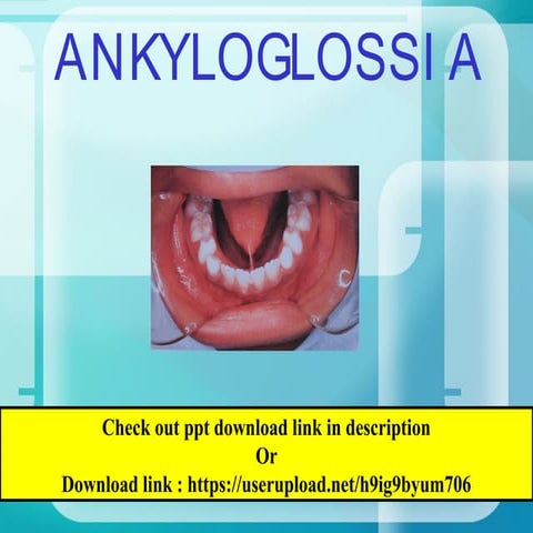 Ankyloglossia a congenital oral anomaly | PPT
