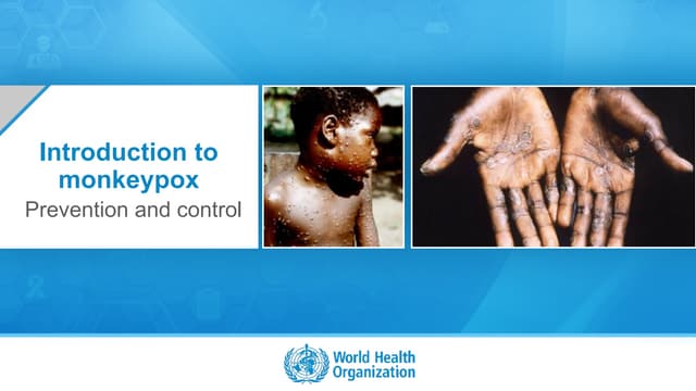 Monkey Pox Virus | PPTX