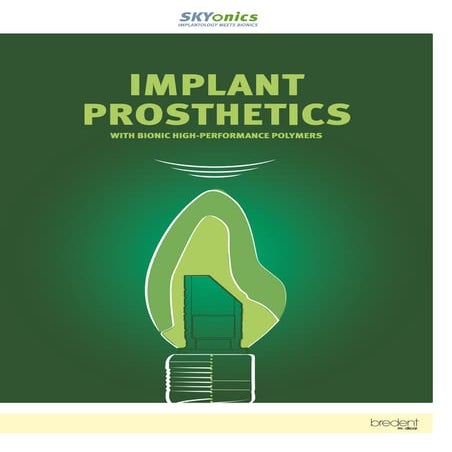 009912GB_SKYonics Implant Prosthetics.pdf