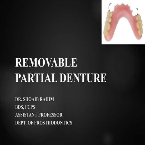 01. removable partial denture | PPTX