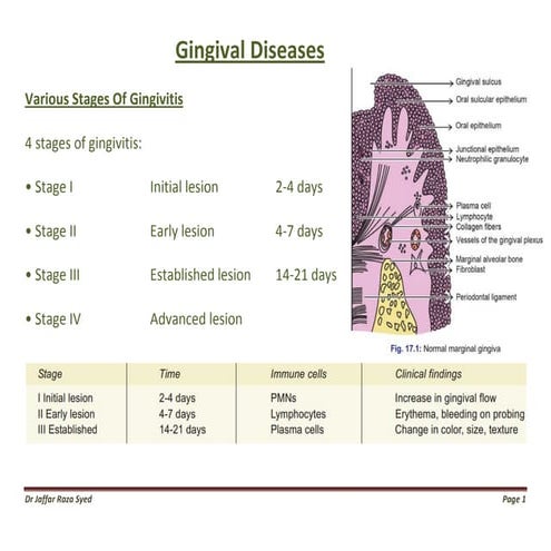 019.gingival diseases | PDF