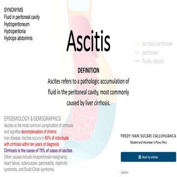 Ascitis - | PPTX