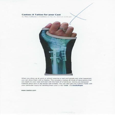 01 castoo a tattoo for your cast | PDF