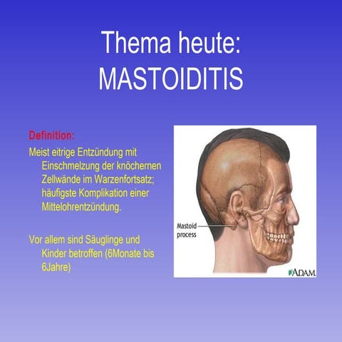 Complications of mastoiditis | PPTX
