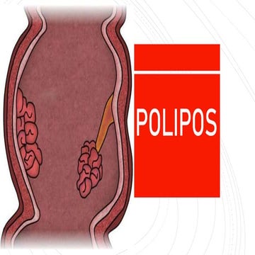 01 POLIPOS.pptx