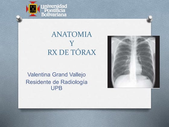 Radiografia De Torax Normal Rotulada
