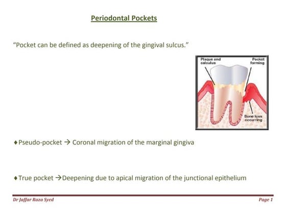 Peridontal pocket | PPT