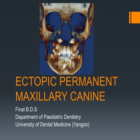 027 Ectopic Eruption of Max Canine.pdfiii | PDF