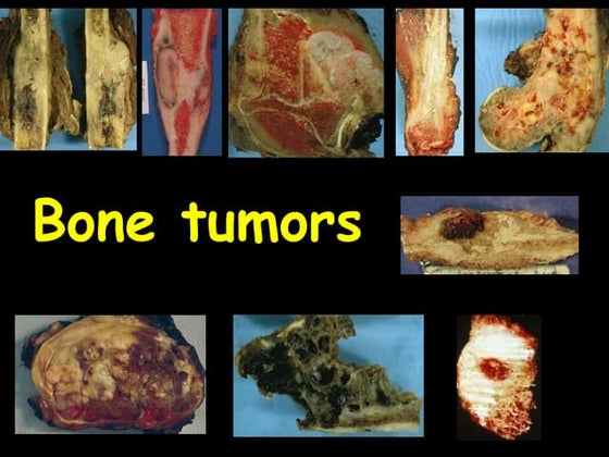 Bone pathology summary for undergraduate | PPT