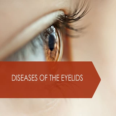02 DISEASES OF THE EYE LIDS (1).pdf medicine | PPT | Free Download