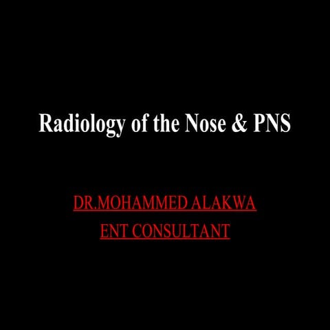 02 Radiology of nose and pns.PPT Dr alakwa amran | PPT