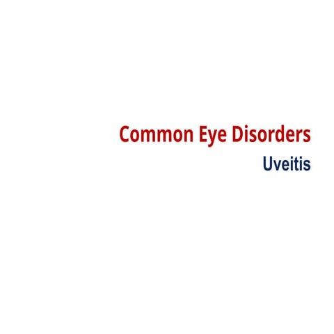 Uveitis | PPT