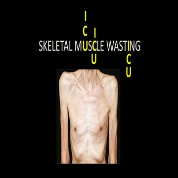 Muscle wasting in ICU: Fat, Feed and Futility | PPTX