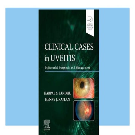 PDF Download Clinical Cases in Uveitis Differential Diagnosis and ...