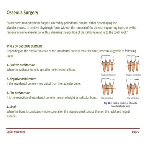 037. osseous surgery | PDF