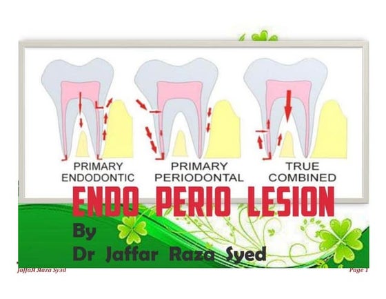 Endo perio lesions /certified fixed orthodontic courses by Indian ...