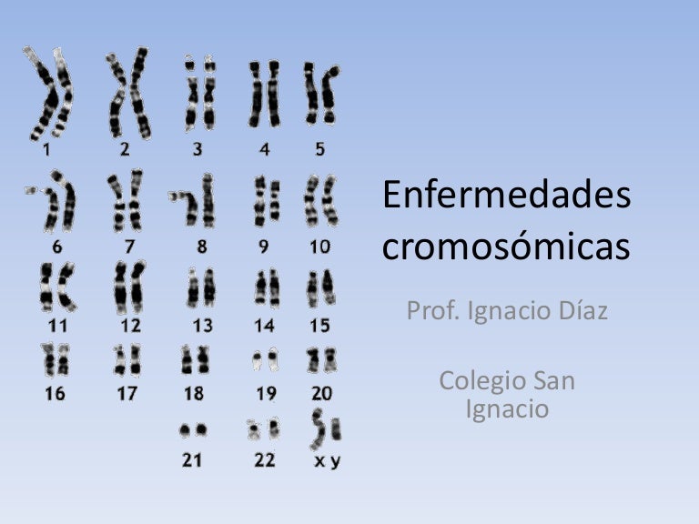 Enfermedades cromosómicas