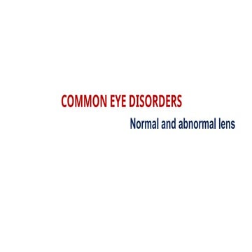 03 Normal and abnormal lens_1.pp( lens asone of most part used in ...