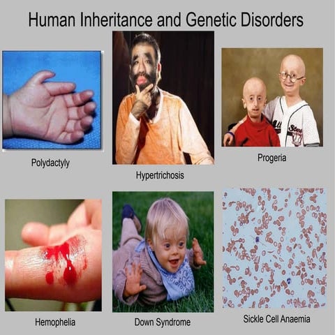 Human Inheritance & Genetic Disorders | PPT