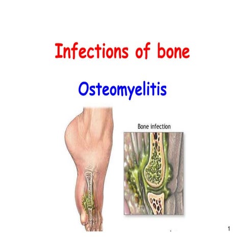 04 Bone non neoplastic part-2 | PPT