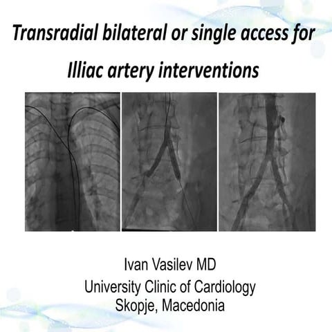 Aorto iliac interventions | PPTX