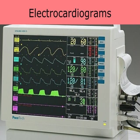 05 ecg 2011 | PPT