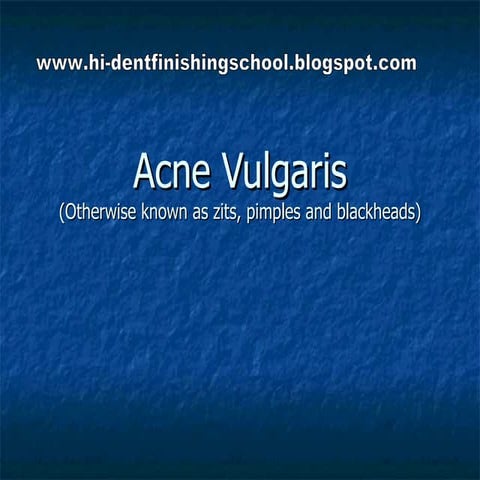 Acne Vulgaris | PDF
