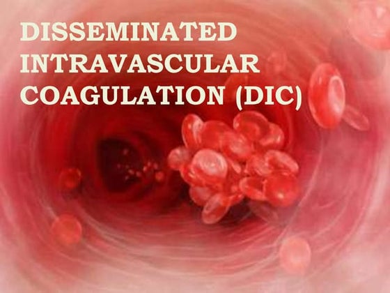 Disseminated intravascular coagulation ppt | PPT