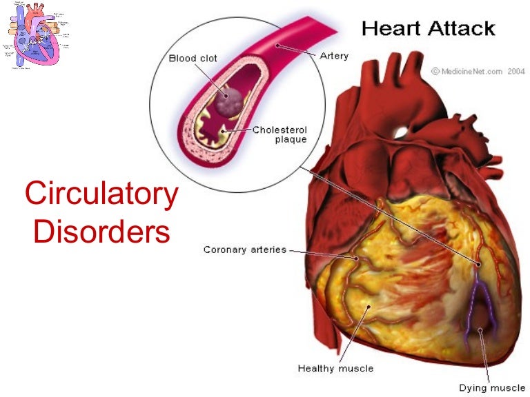 06 circulatory disorders