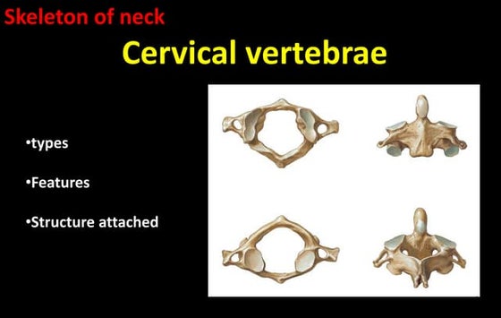 Atlas(C1) & Axis(C2) Vertebrae.pptx | Death, Injury, or Military Conflict | Sensitive Topics