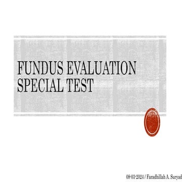 Fundus evaluation - special test for preoperative cataract surgery | PPT