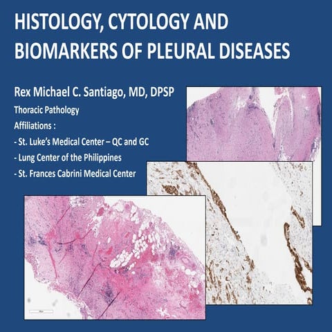 07 histology, cytology and biomarkers in pleural diseases | PDF