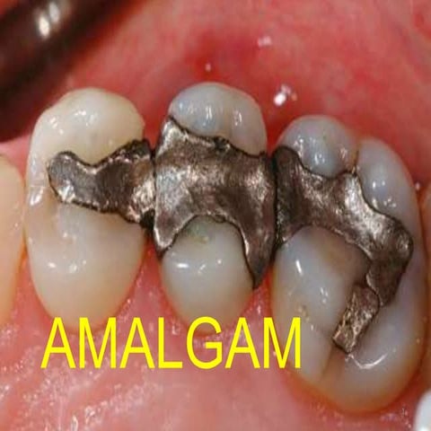 08.amalgam | PPTX