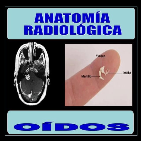 Anatomy and Imaging of the Human Ear: CT and MRI Applications | PPT