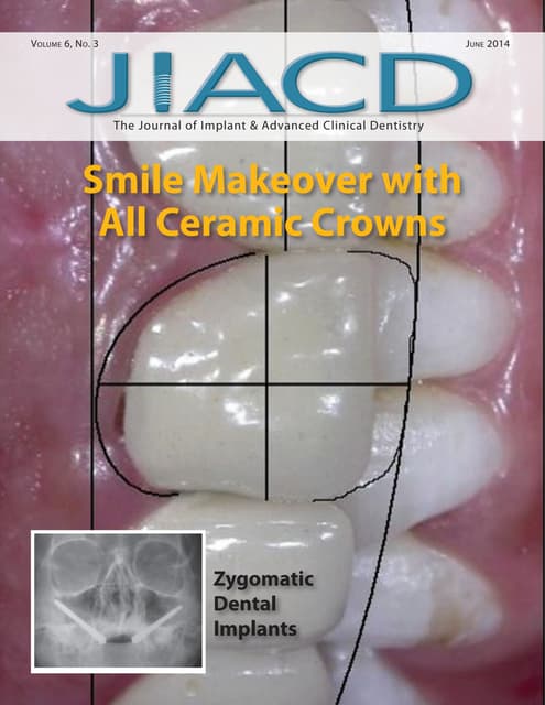 PATIENT SPECIFIC IMPLANTS.pptx