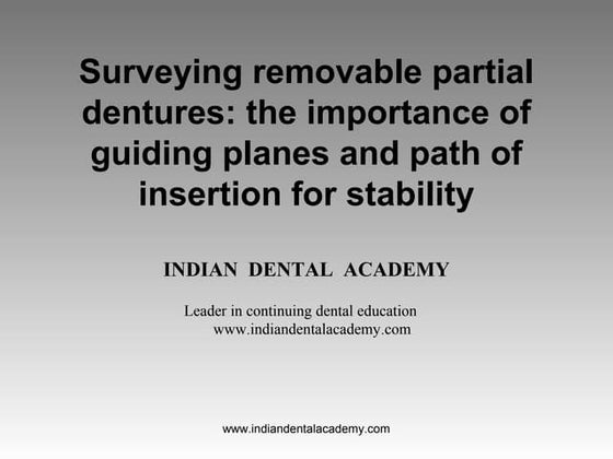 removable partial denture survey lines, path of insertion, guide planes ...