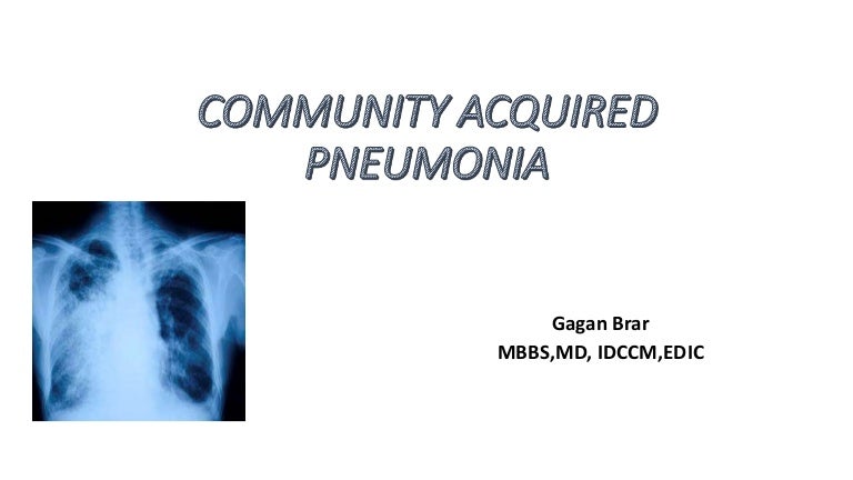 Community Acquired Pneumonia