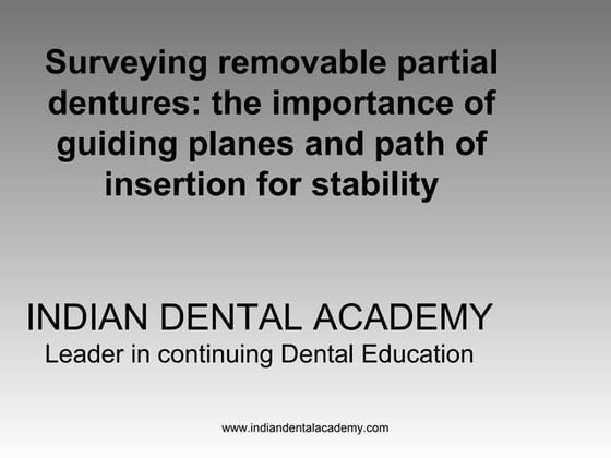 removable partial denture survey lines, path of insertion, guide planes ...