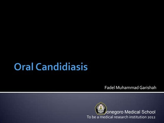 Oral Candidiasis (Poster) | PPT