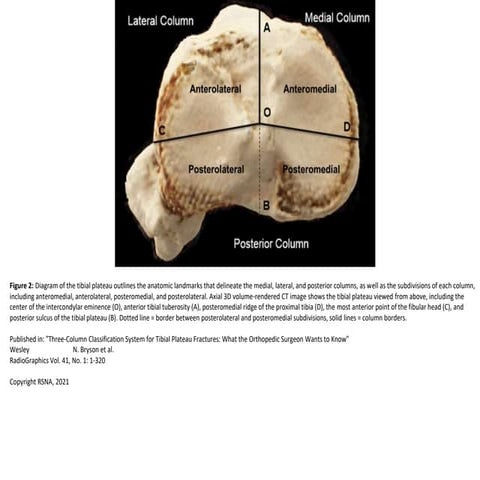 proximal tibia | PPTX