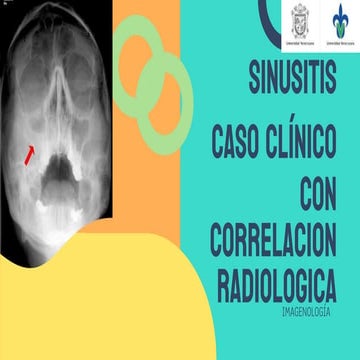 1. SINUSITIS CASO CLINICO CON CORRELACION RADIOLOGICA.pptx