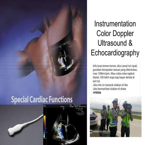 1. Echocardiogrphy Instrumentasi and color Doppler, Ir Cahyo.pdf