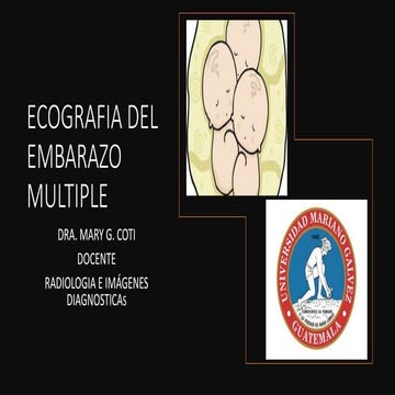 1. ECOGRAFIA DEL EMBARAZO MULTIPLE r2.pptx