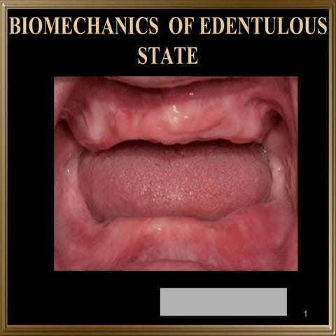 1. Biomechanics of edentulous state.pptx