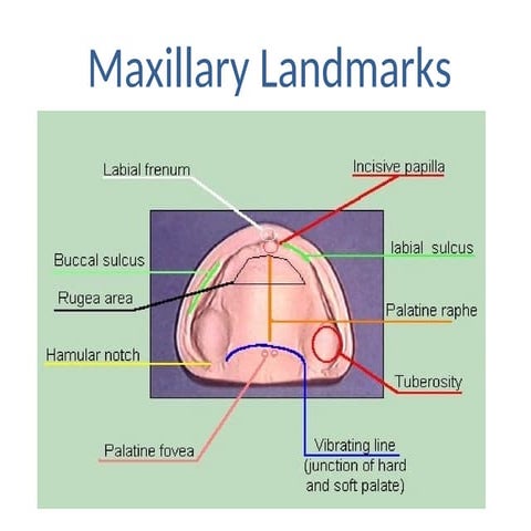 1. Maxillary-Landmarks PROSTHODONTICS .ppt