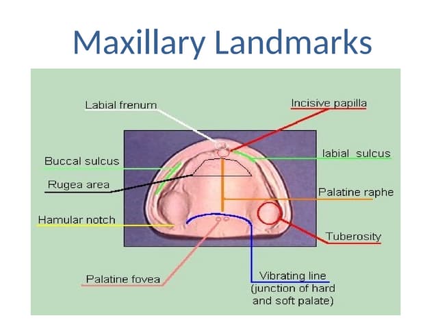 Anatomical landmarks of edentulous maxillary arch | PPTX